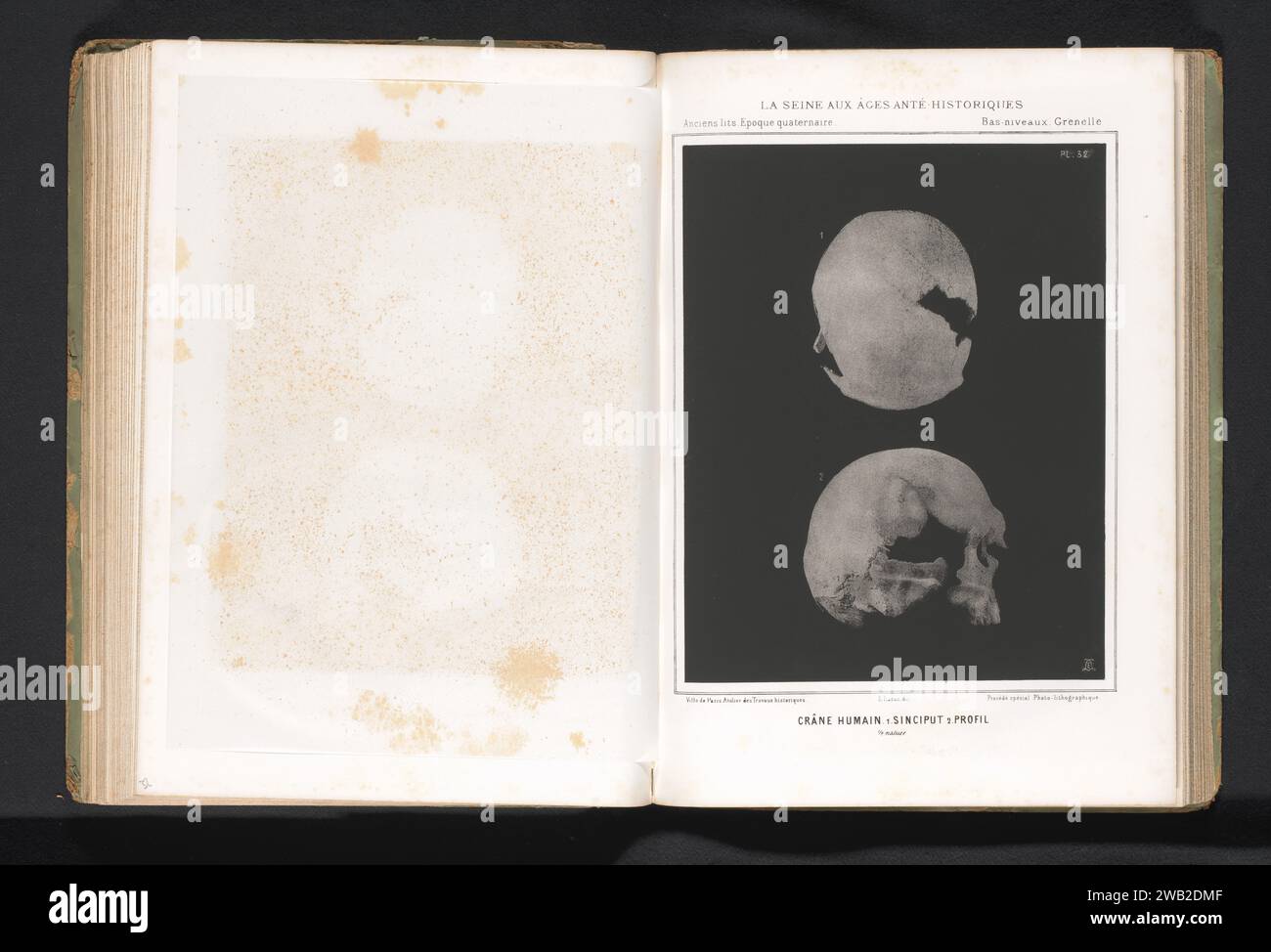 Two views of a human skull, top view and and profil, Ville de Paris ...