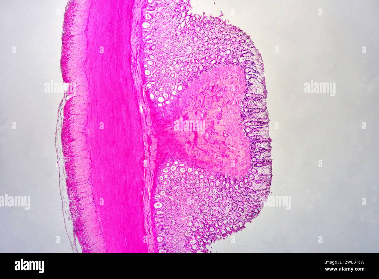 Human vermiform appendix cross section showing (left to right) serous ...