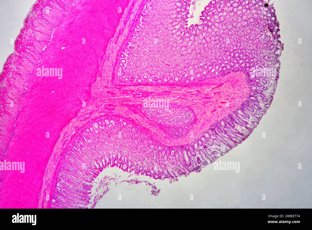 Human vermiform appendix cross section showing (left to right) serous ...