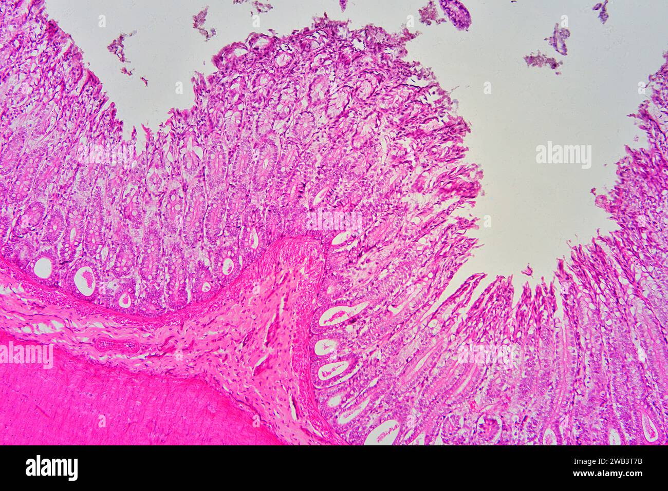 Human Vermiform Appendix Cross Section Showing Bottom To Top