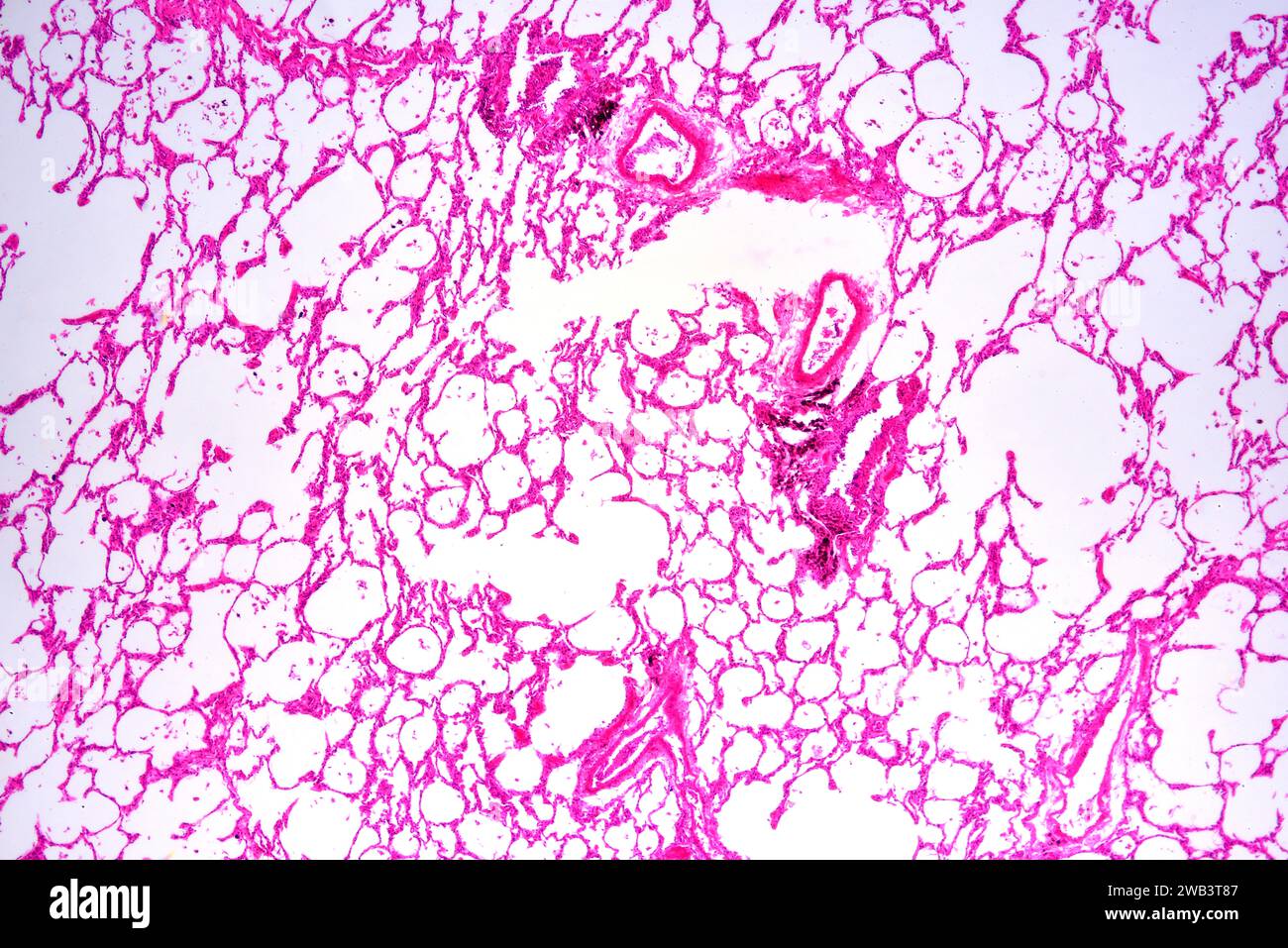 Human lung section showing alveoli, bronchiole and blood vessels. X30 ...