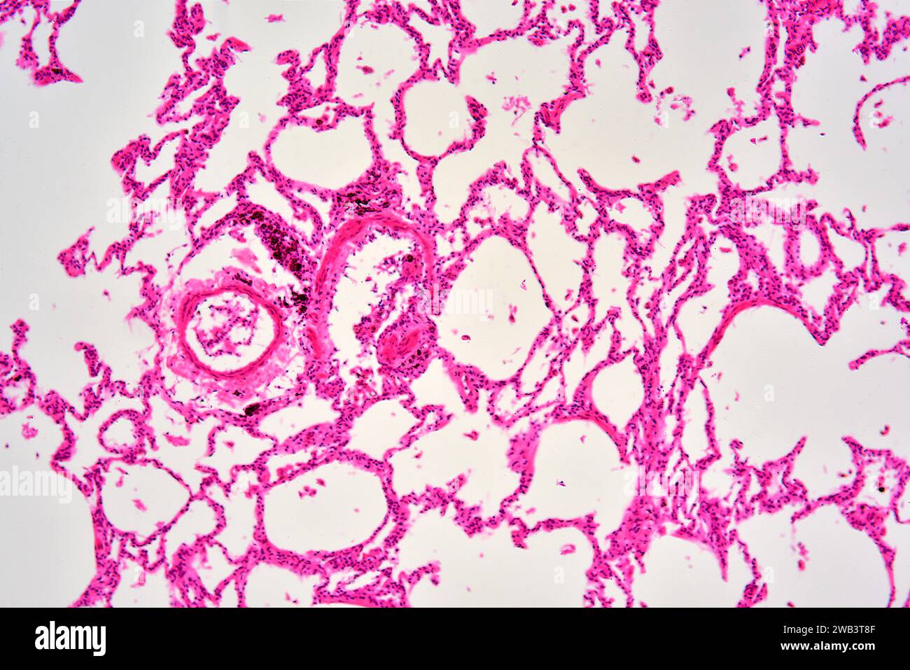 Photomicrograph of human lung alveoli hi-res stock photography and ...