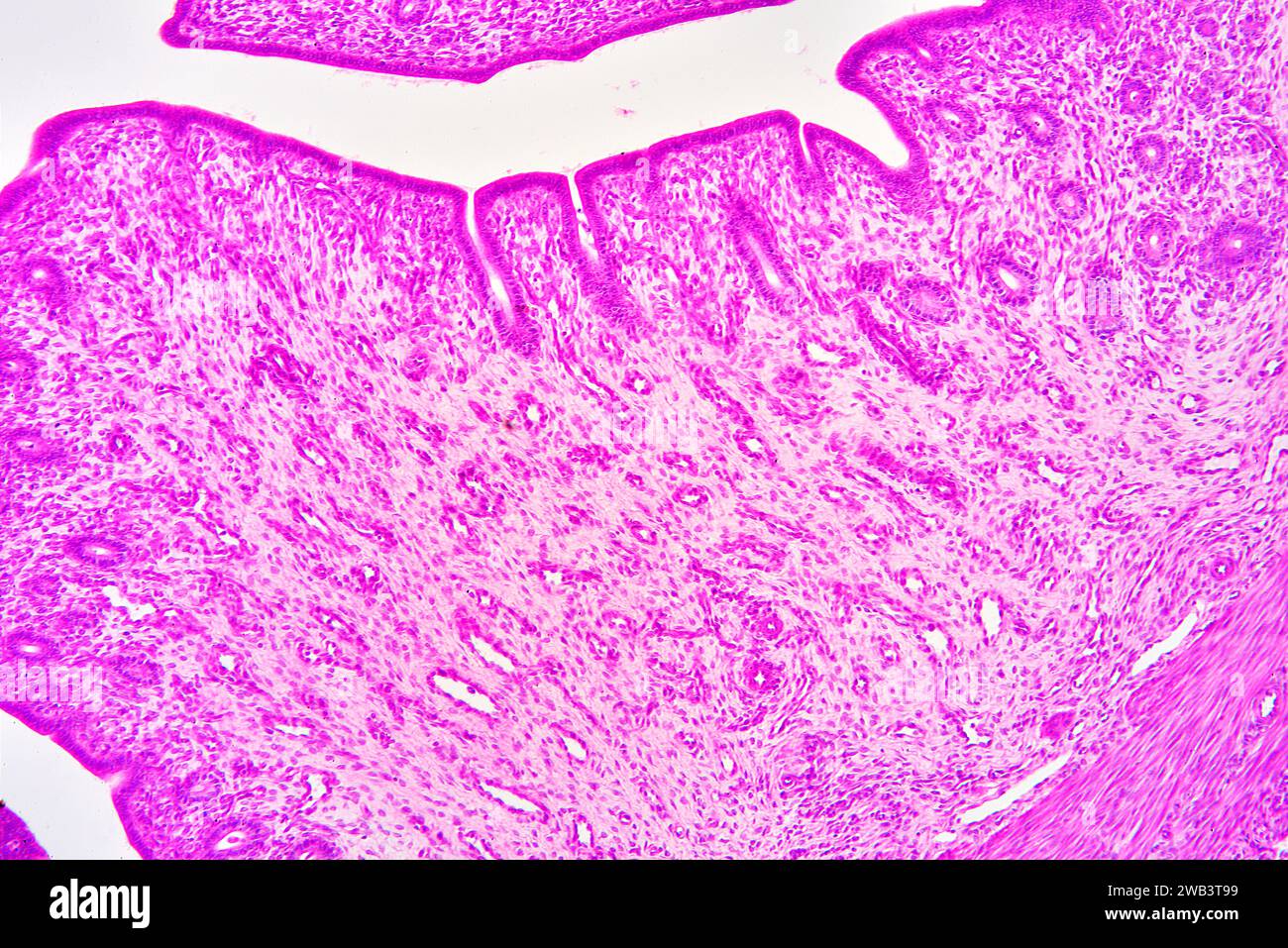 Endocervix mucosa hi-res stock photography and images - Alamy
