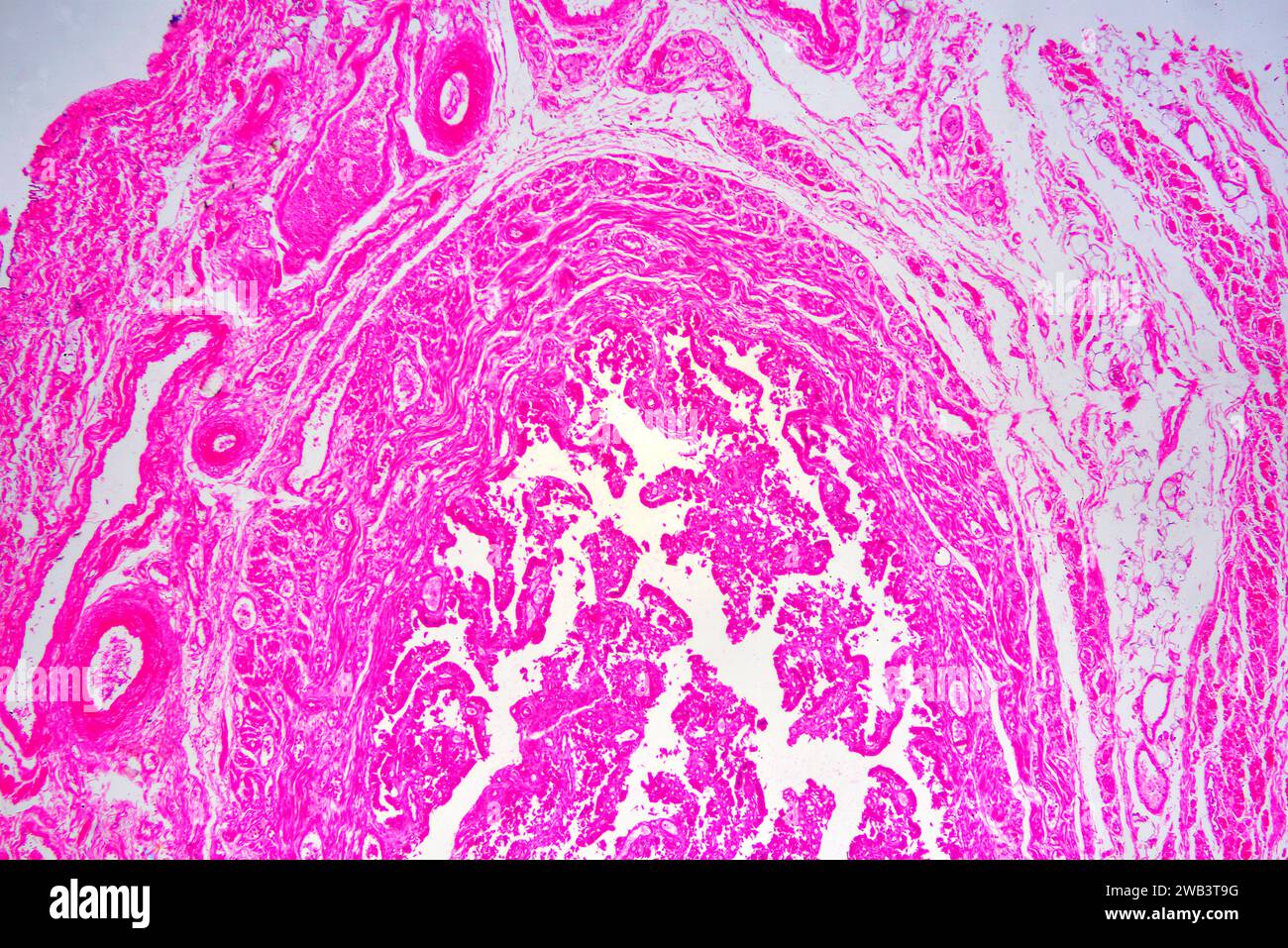 Fallopian tube hi-res stock photography and images - Alamy