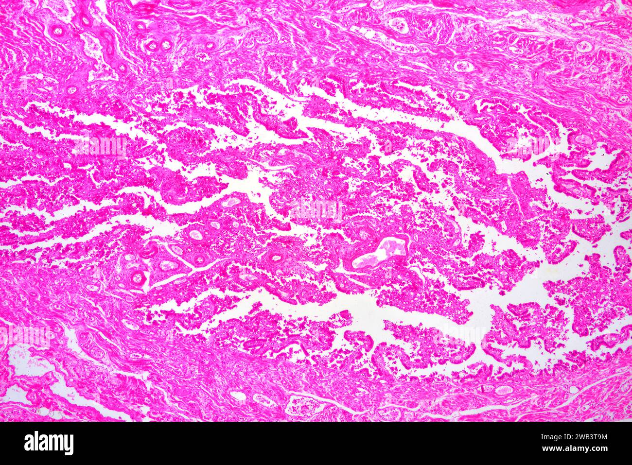 Fallopian tube hi-res stock photography and images - Alamy