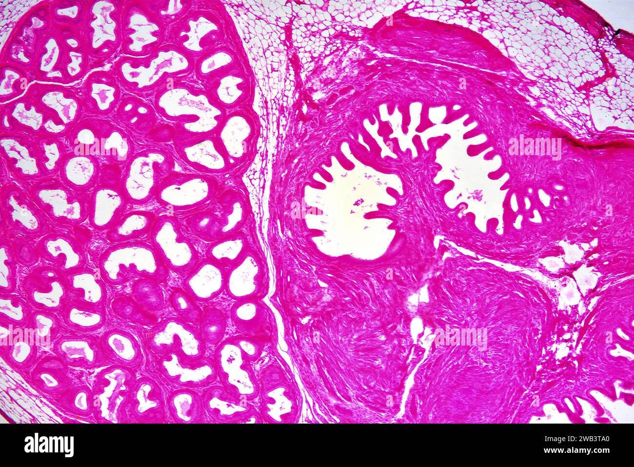 Epididymis micrograph hi-res stock photography and images - Alamy