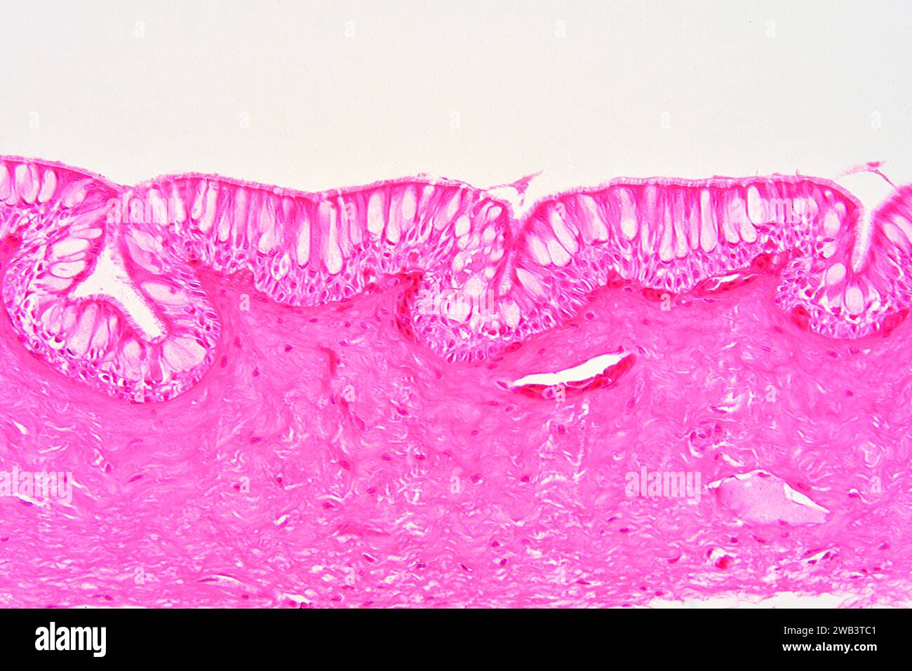 Human columnar ciliated epithelium hi-res stock photography and images ...