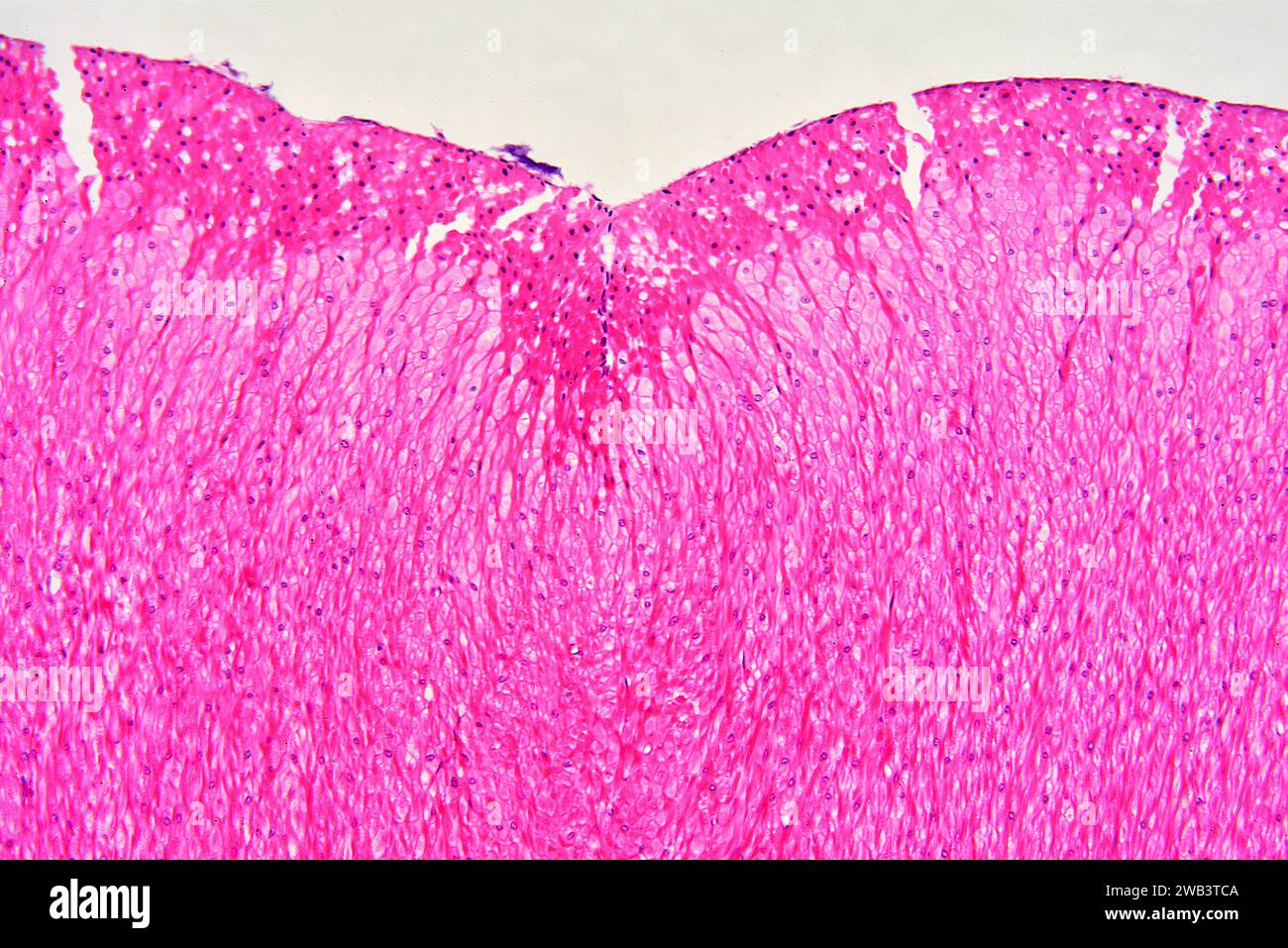 Columnar epithelium hi-res stock photography and images - Alamy