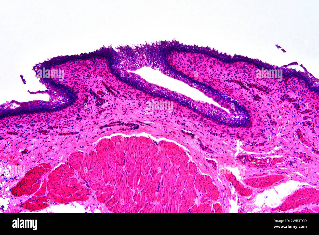 Human transitional epithelium hi-res stock photography and images - Alamy