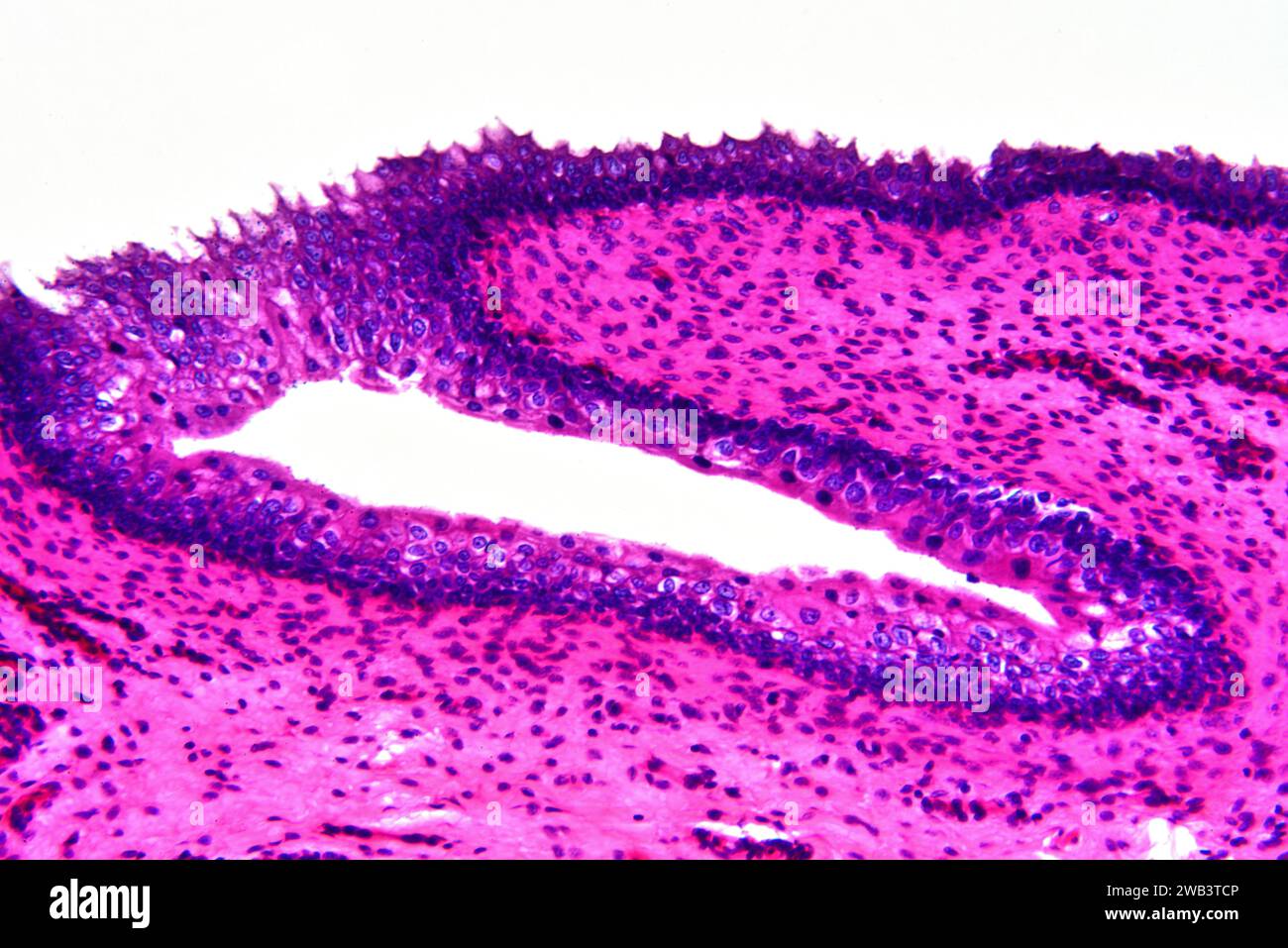 Smooth muscle tissue hi-res stock photography and images - Alamy