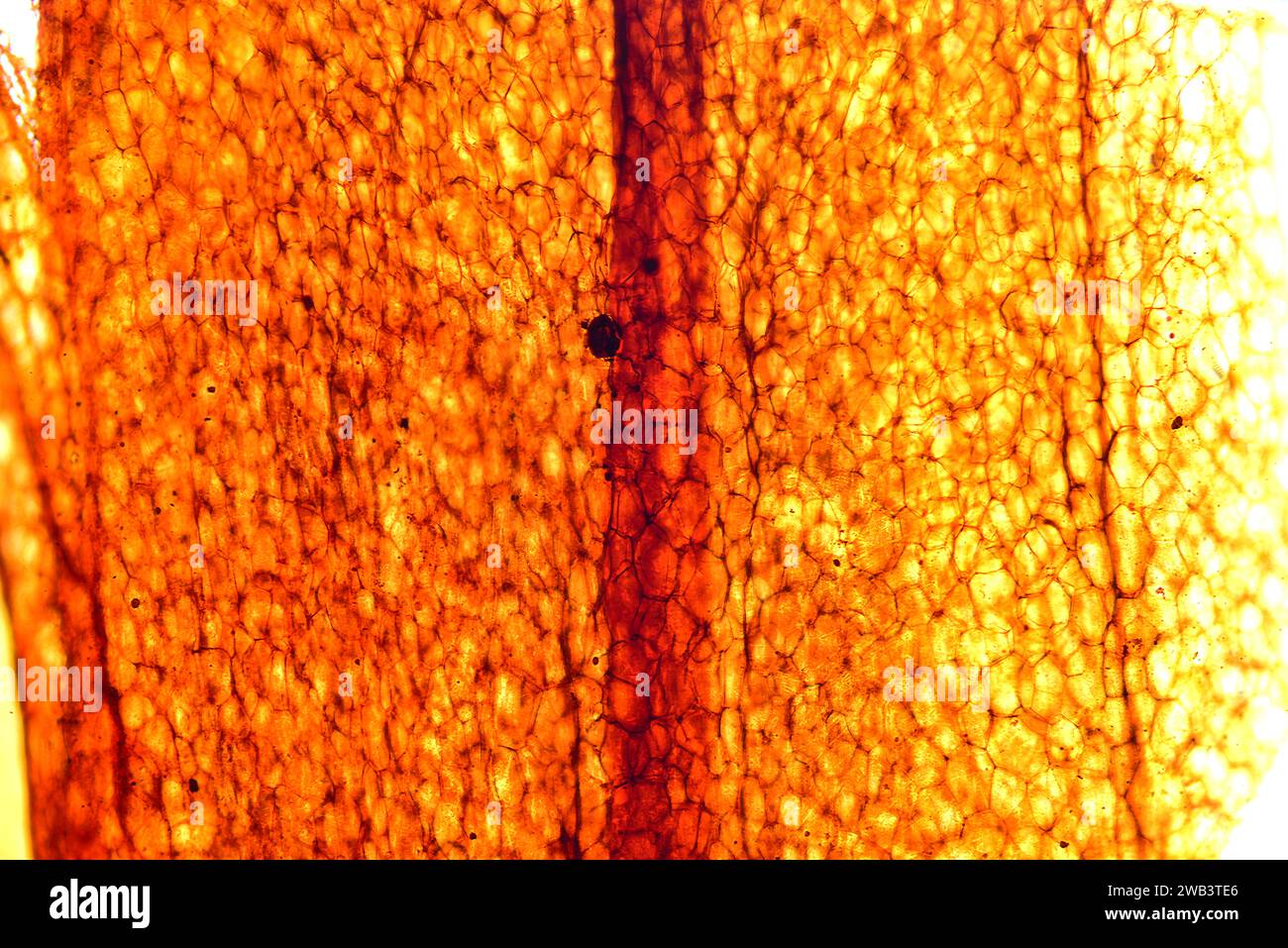 Human simple squamous epithelium. X75 at 10 cm wide Stock Photo - Alamy