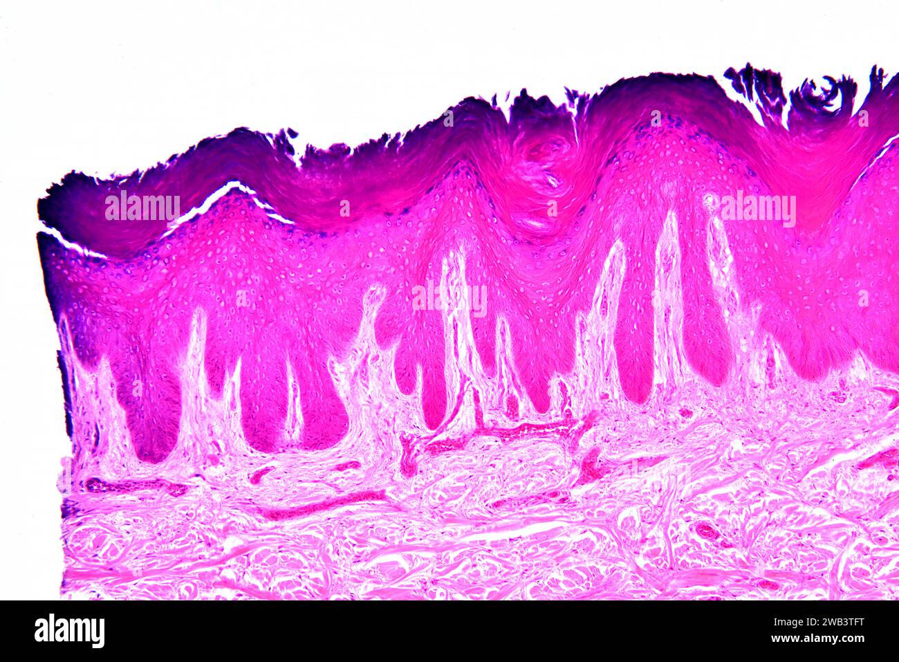 Stratified squamous epithelium from human hand skin showing keratinized ...