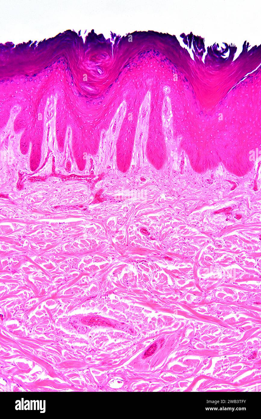 Nonkeratinized Stratified Squamous Epithelium Of The Human Esophagous ...