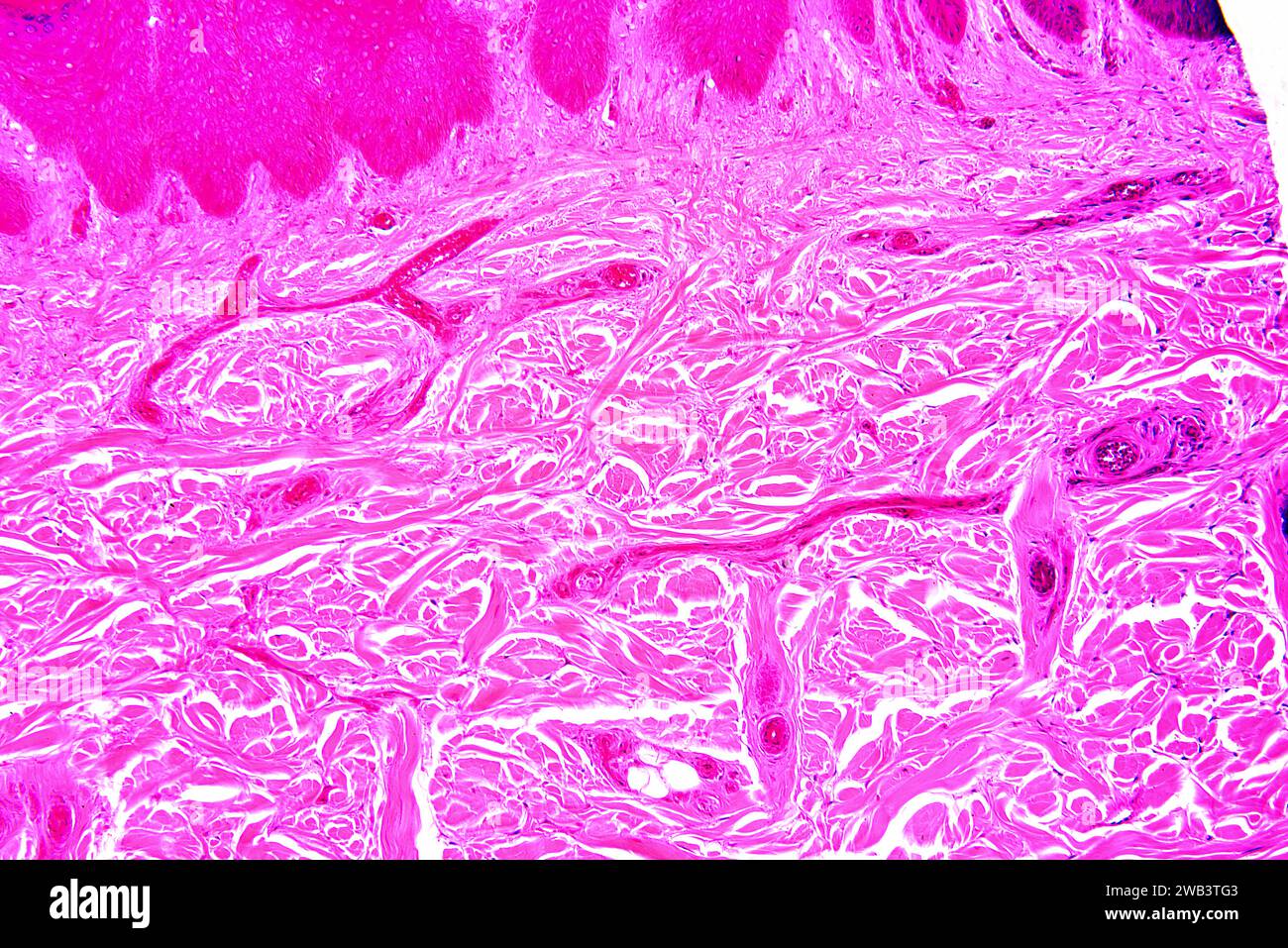 Human hand skin showing basal epidermis and dermis with connective ...