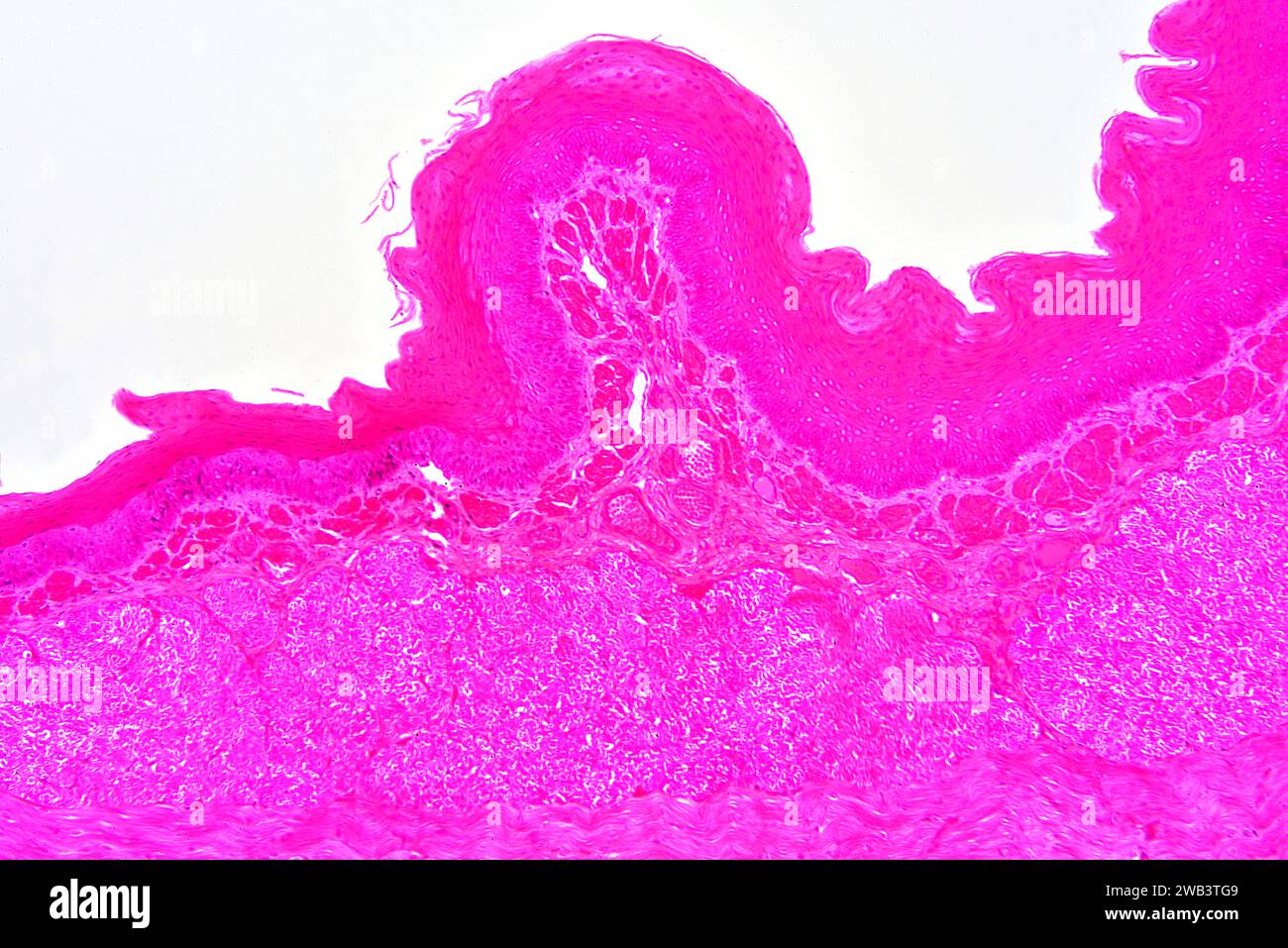 Keratinized Stratified Squamous Epithelium The Simple Stratified