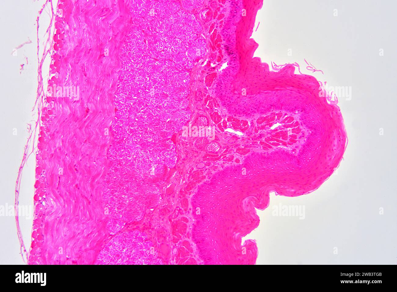 Stratified Squamous Epithelium Non Keratinized Esophagus Section Of