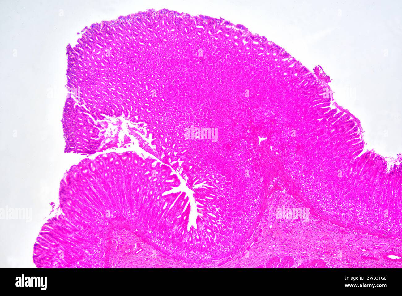 Stomach histology gastric hi-res stock photography and images - Alamy