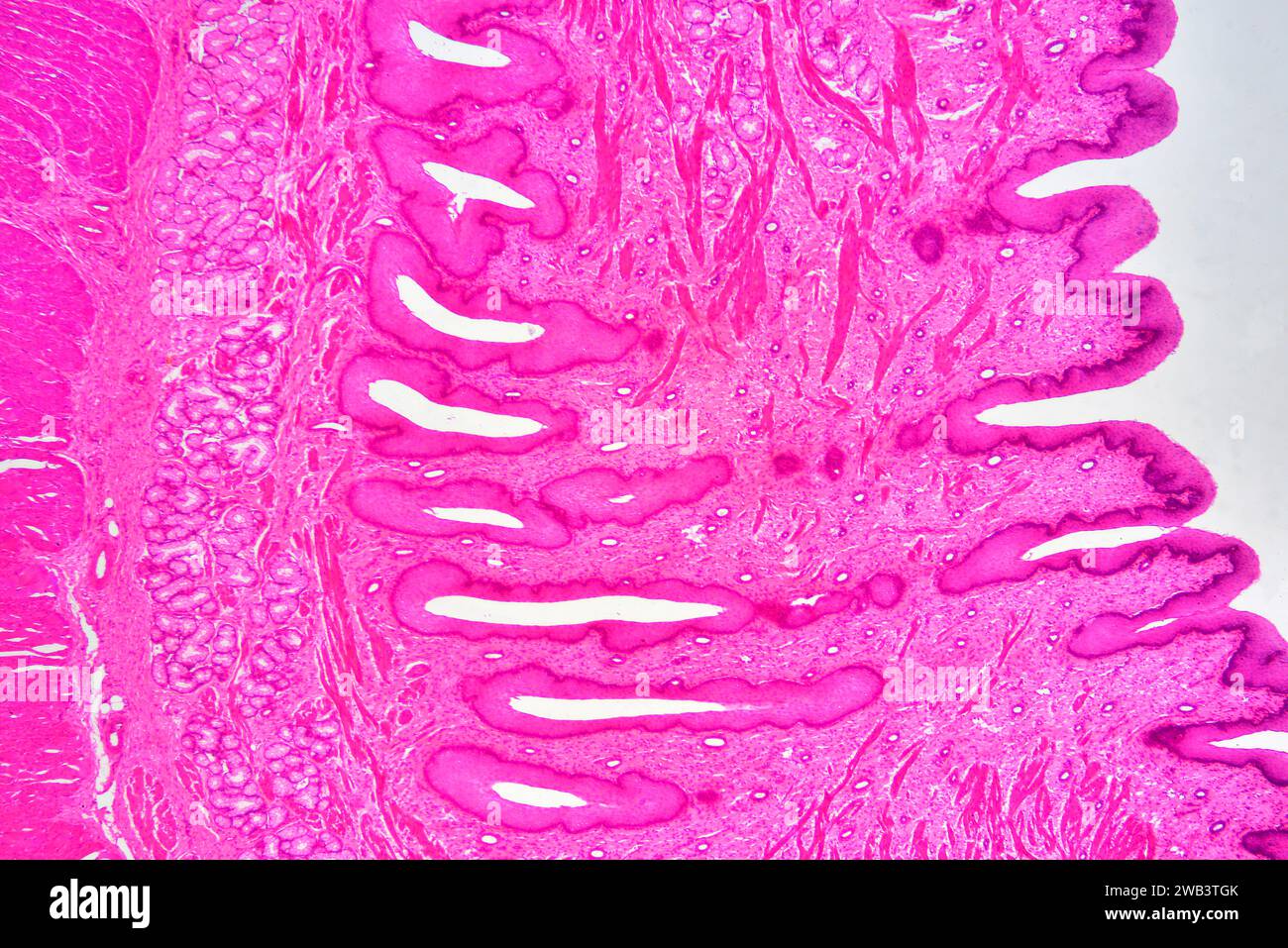 Human stomach in cardia region. X25 at 10 cm wide Stock Photo - Alamy