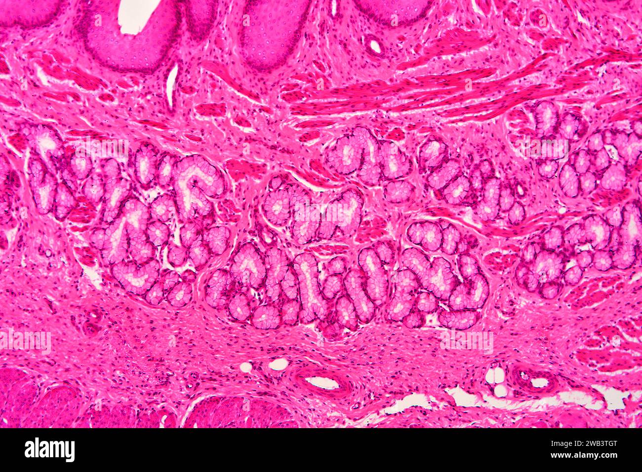 Human stomach in cardia region. X25 at 10 cm wide Stock Photo - Alamy