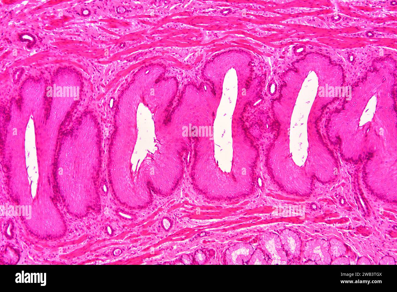Gastric glands hi-res stock photography and images - Alamy