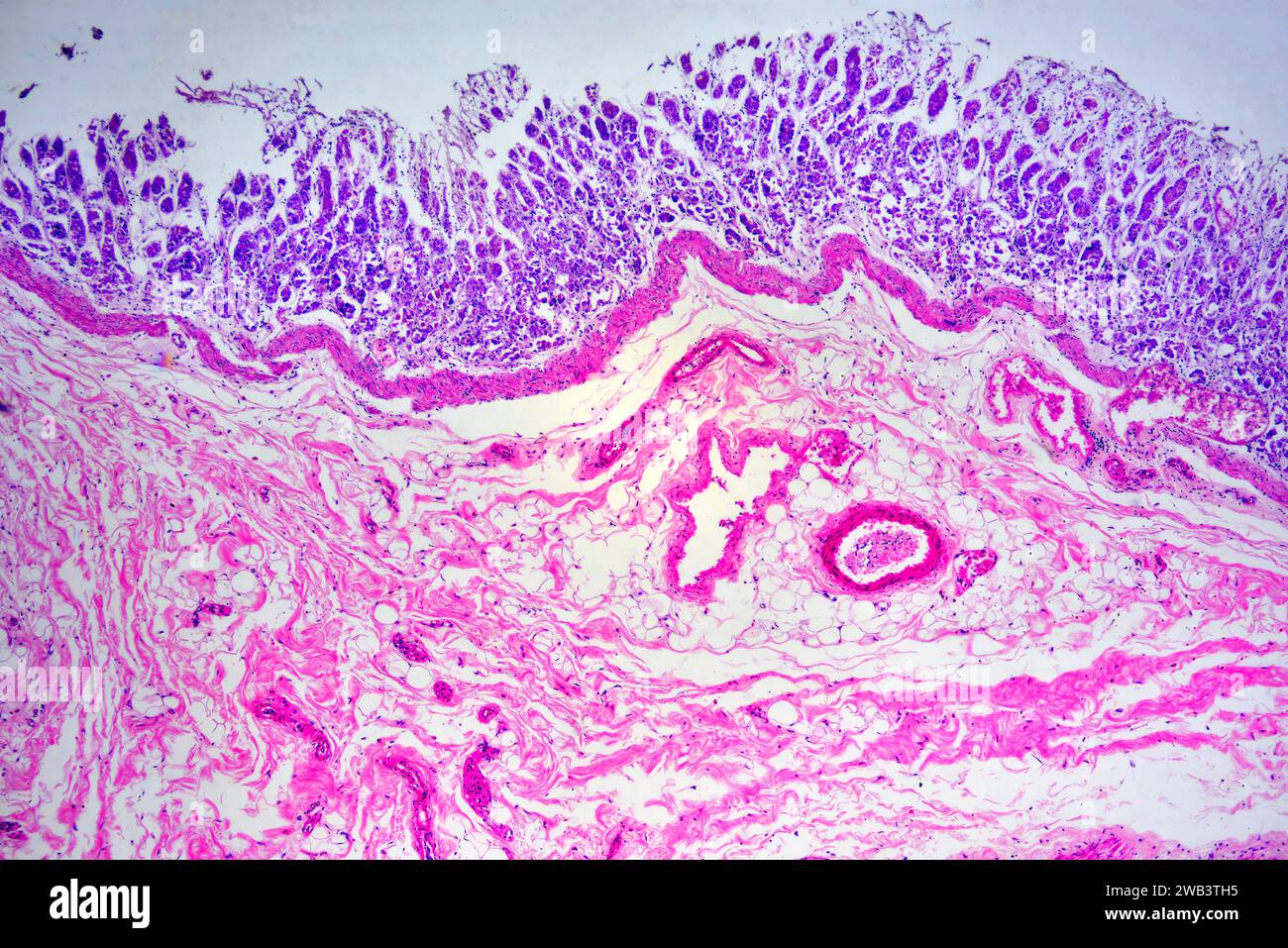 Human stomach in fundus region. X25 at 10 cm wide Stock Photo - Alamy