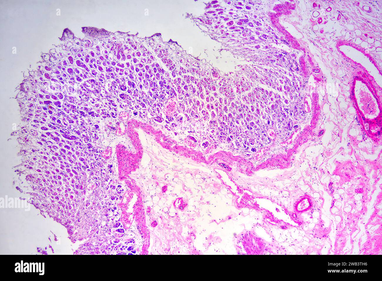 Human stomach in fundus region. X25 at 10 cm wide Stock Photo - Alamy