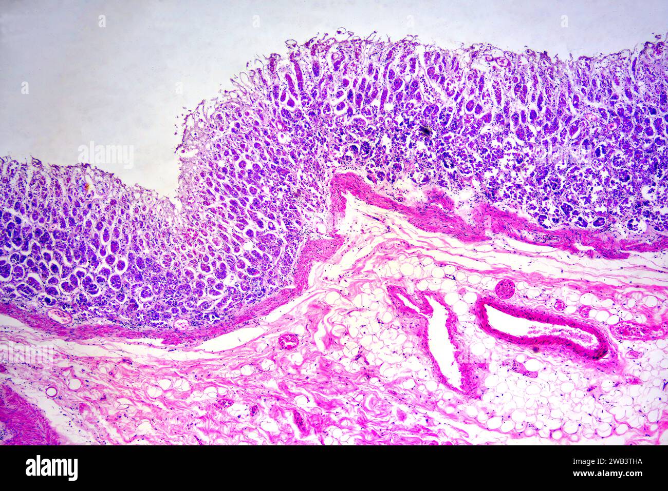 Human stomach in fundus region. X25 at 10 cm wide Stock Photo - Alamy