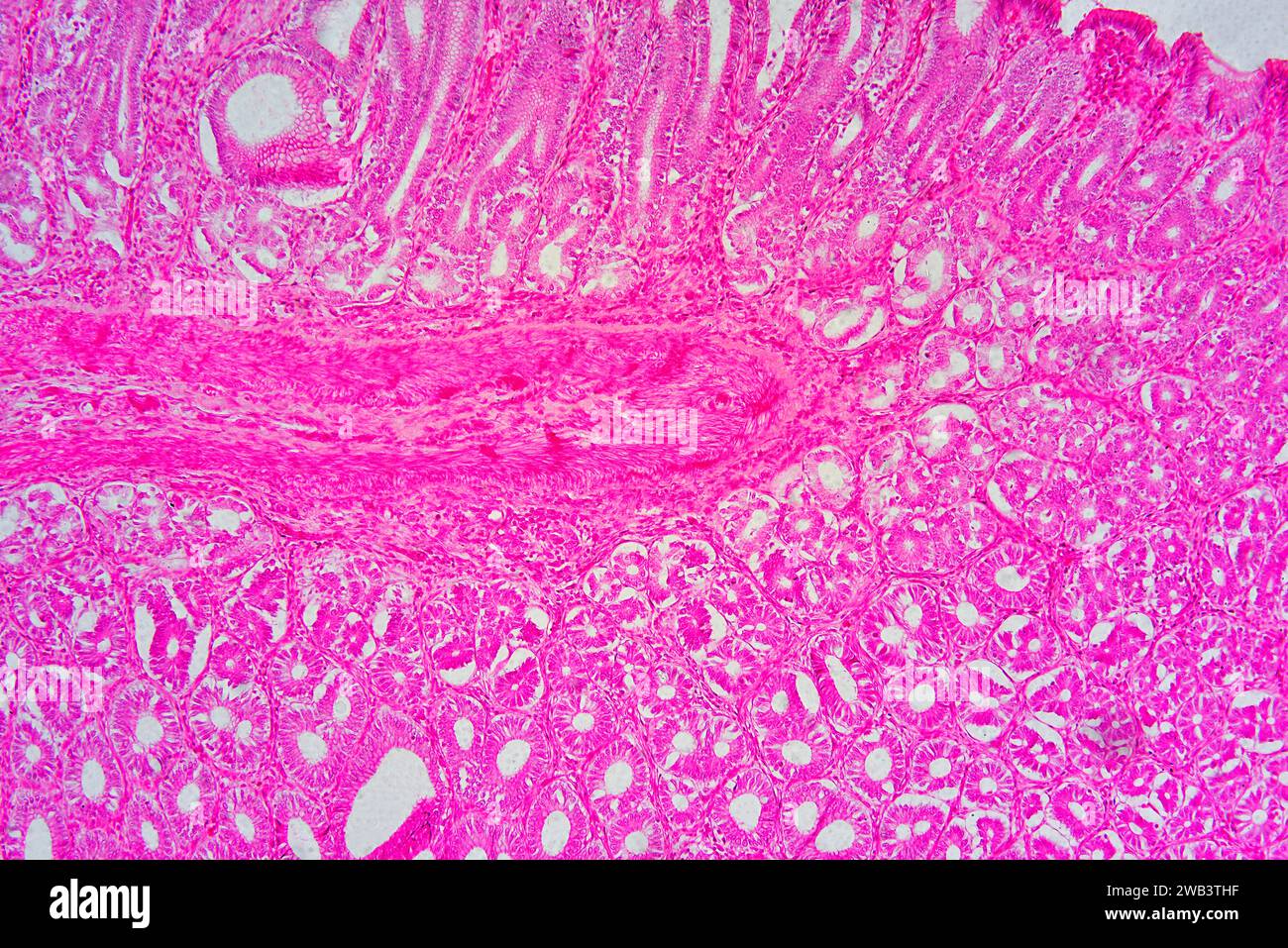 Stomach histology gastric hi-res stock photography and images - Alamy