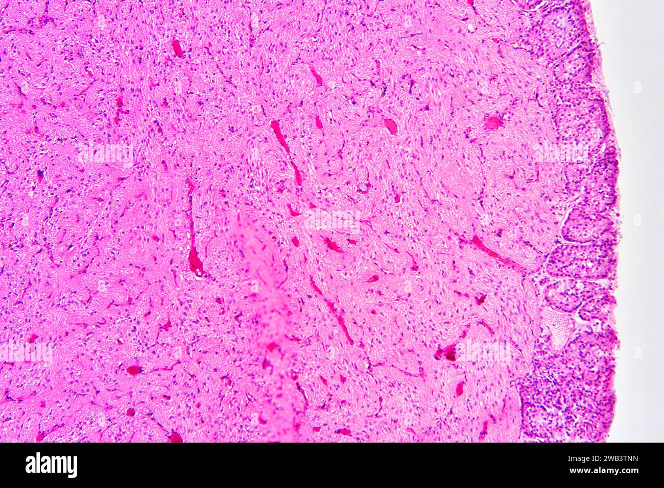 Human hypophyse or pituitary gland. X75 at 10 cm wide Stock Photo - Alamy