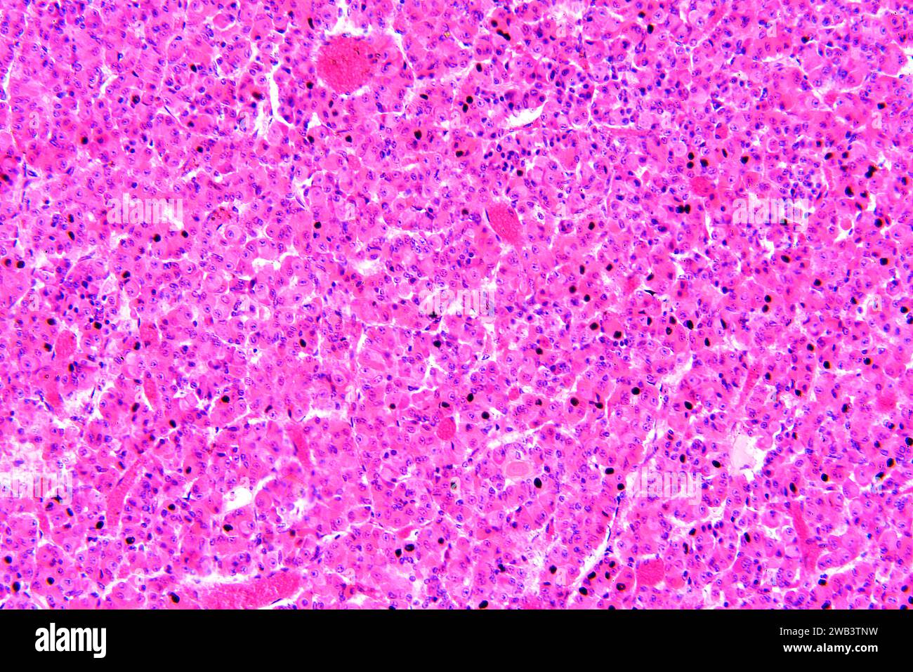Human hypophyse or pituitary gland. X125 at 10 cm wide Stock Photo - Alamy
