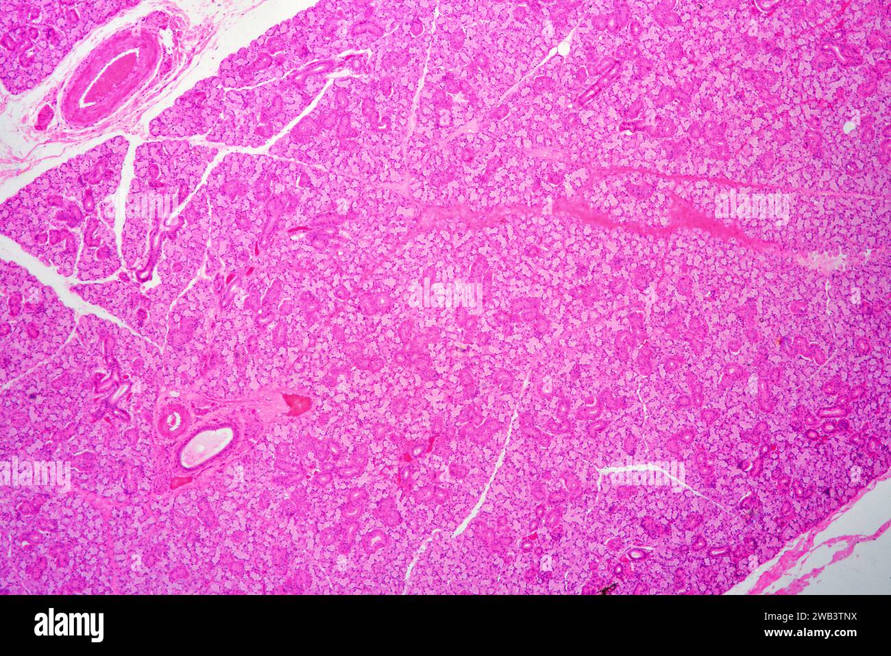 Human salivary gland showing acini, parenchyma, secretory ducts and ...