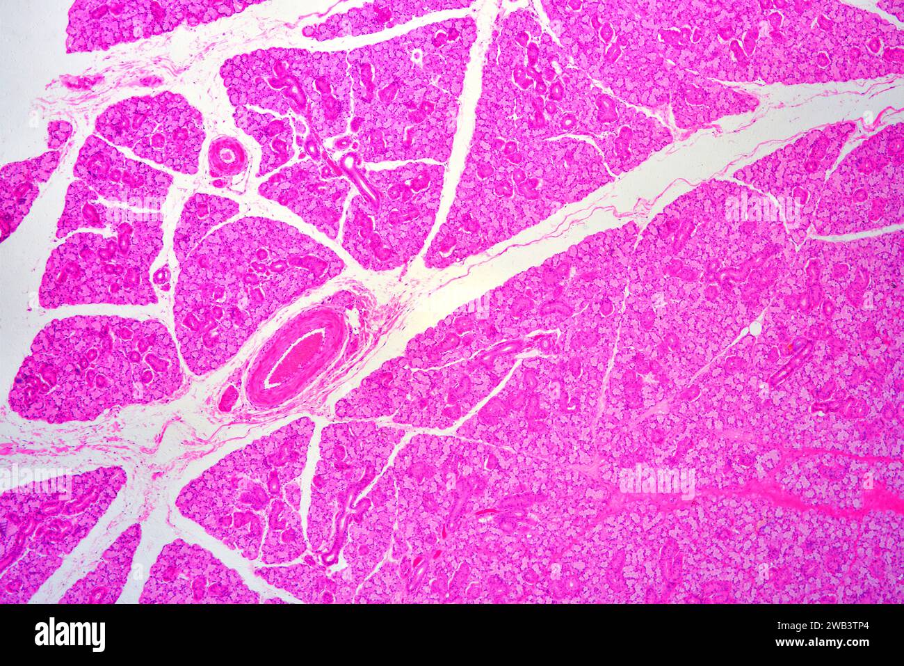 Human salivary gland showing acini, parenchyma, secretory ducts and ...