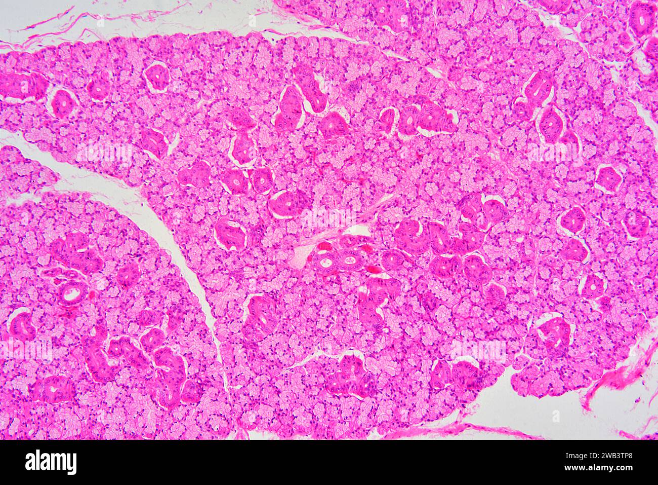 Human salivary gland showing acini, parenchyma, secretory ducts and ...