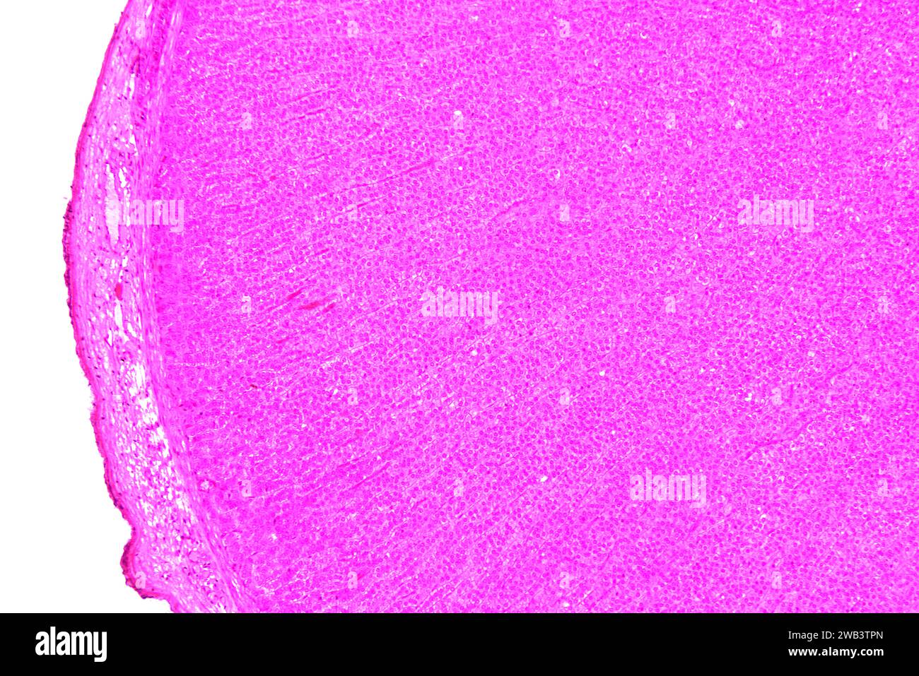 Human adrenal gland section showing from left to right: fibrous capsule ...