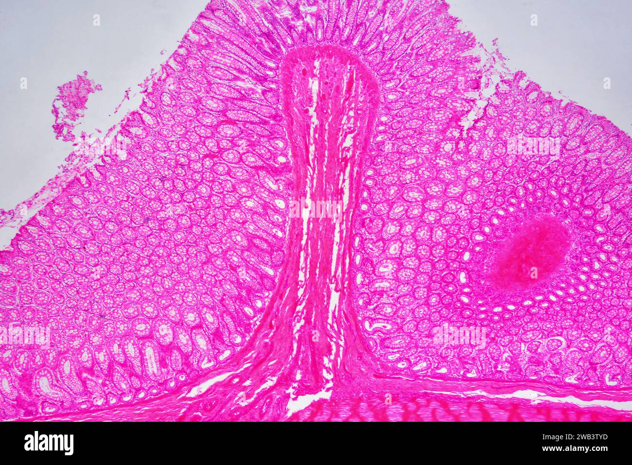 Human Large Intestine Colon Showing Mucosa And Lieberkhun Crypts X25