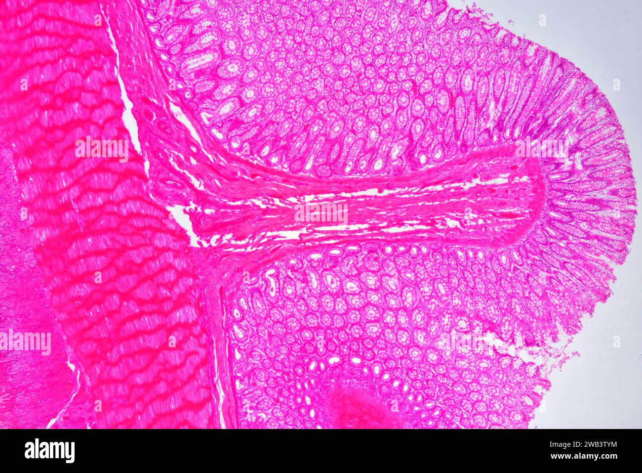 Human large intestine (colon) showing from left to right: muscular ...