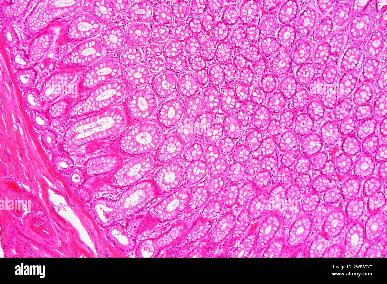 Human large intestine hi-res stock photography and images - Alamy