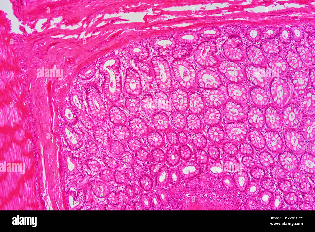 Human large intestine (colon) showing mucosa with Lieberkhun crypts ...