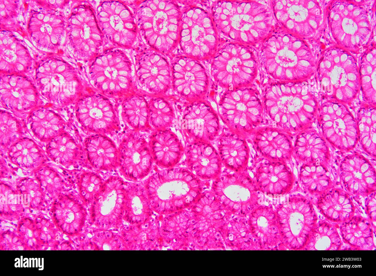 Human large intestine (colon) showing mucosa with Lieberkhun crypts ...