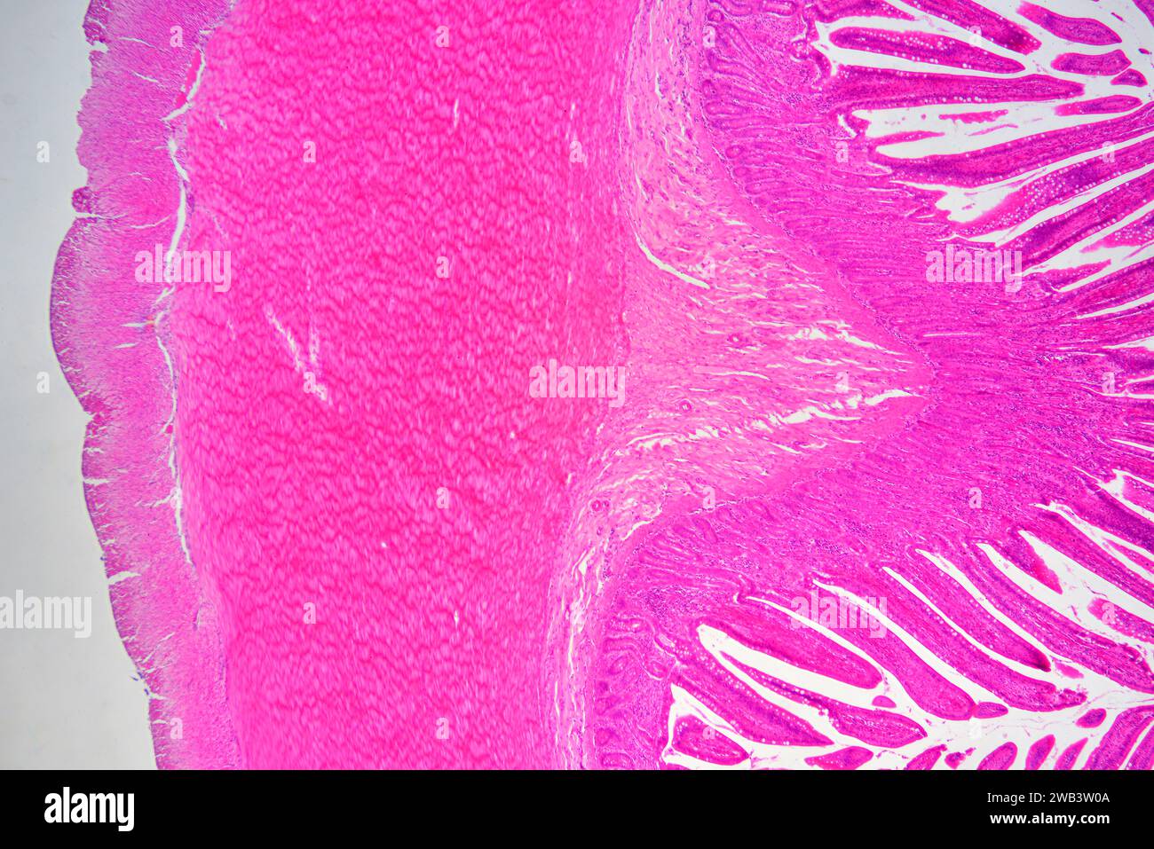 Human small intestine showing from left to right: serosa, muscular ...