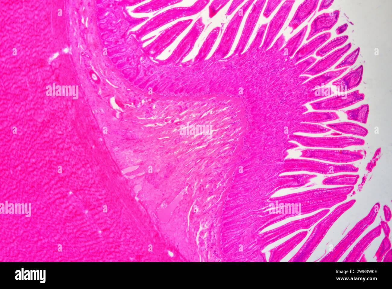 Human small intestine showing from left to right: muscular fibers ...