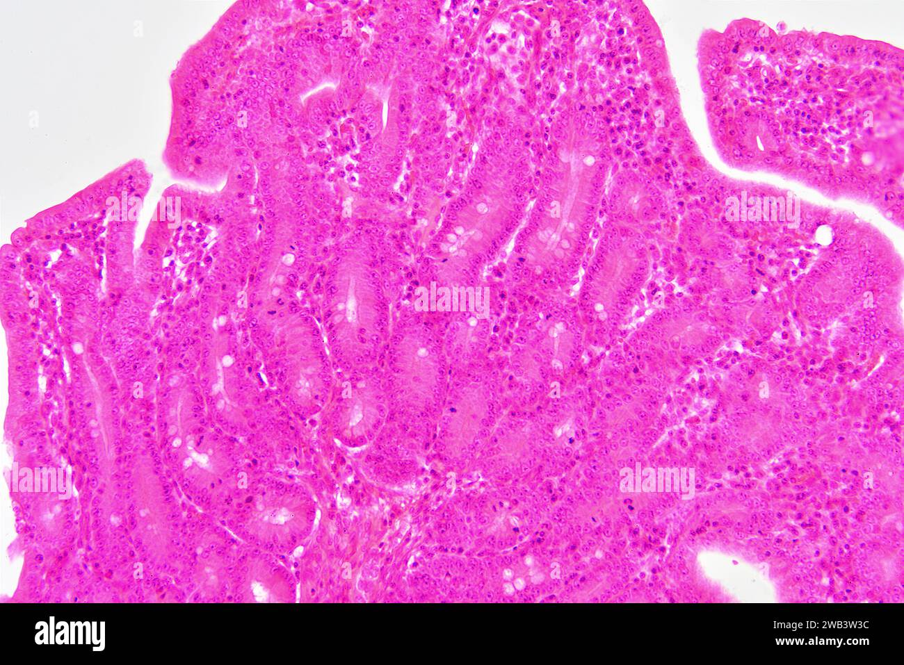 Human small intestine (jejunum) showing mucosa with Lieberkhun crypts ...