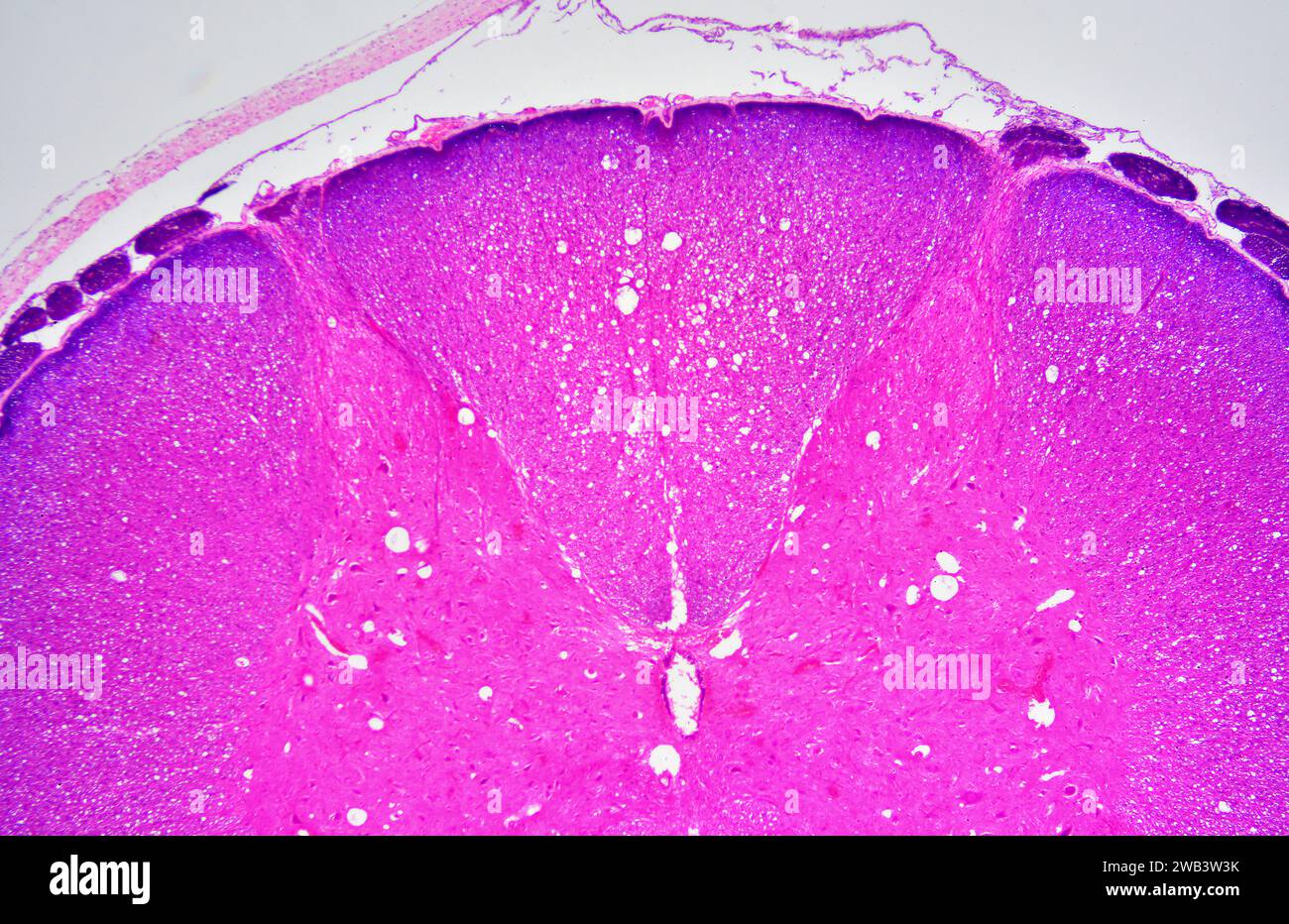 Human spinal cord showing meninges, white matter, grey matter, dorsal and ventral horns and ...