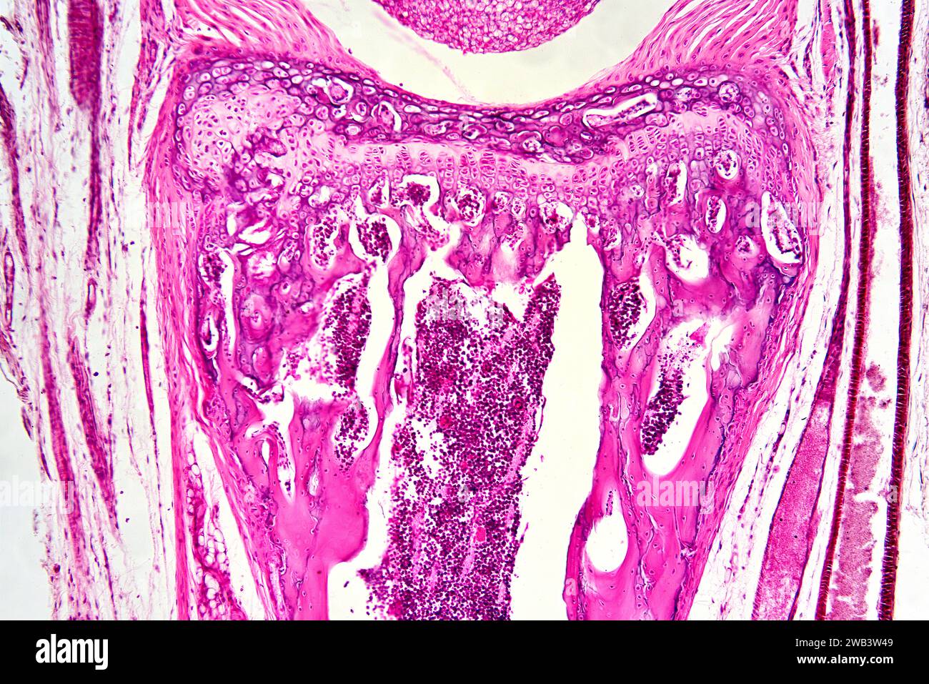 Histology bone marrow hi-res stock photography and images - Alamy