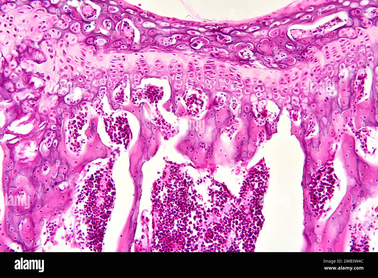 Human red bone marrow, hematopoietic tissue. X125 at 10 cm wide Stock ...