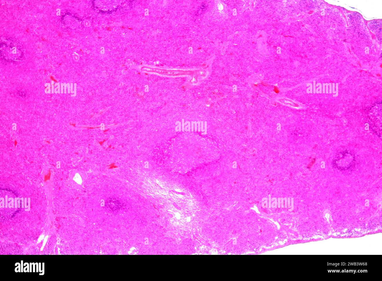 Human spleen (lymphatic organ) showing capsules, red pulp, white pulp ...