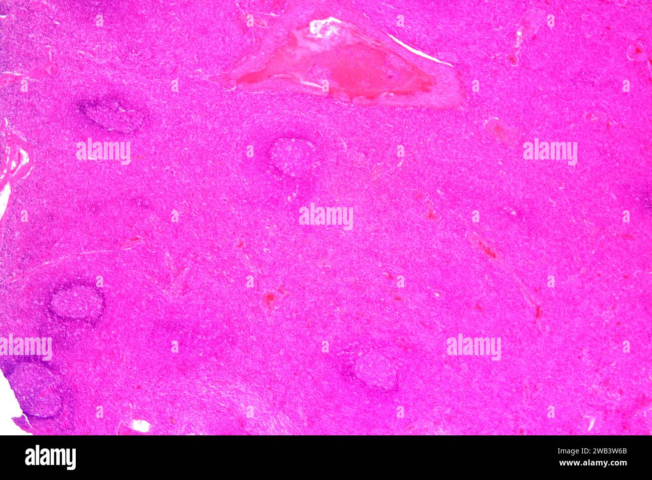 Lymphatic vessel microscope hi-res stock photography and images - Alamy