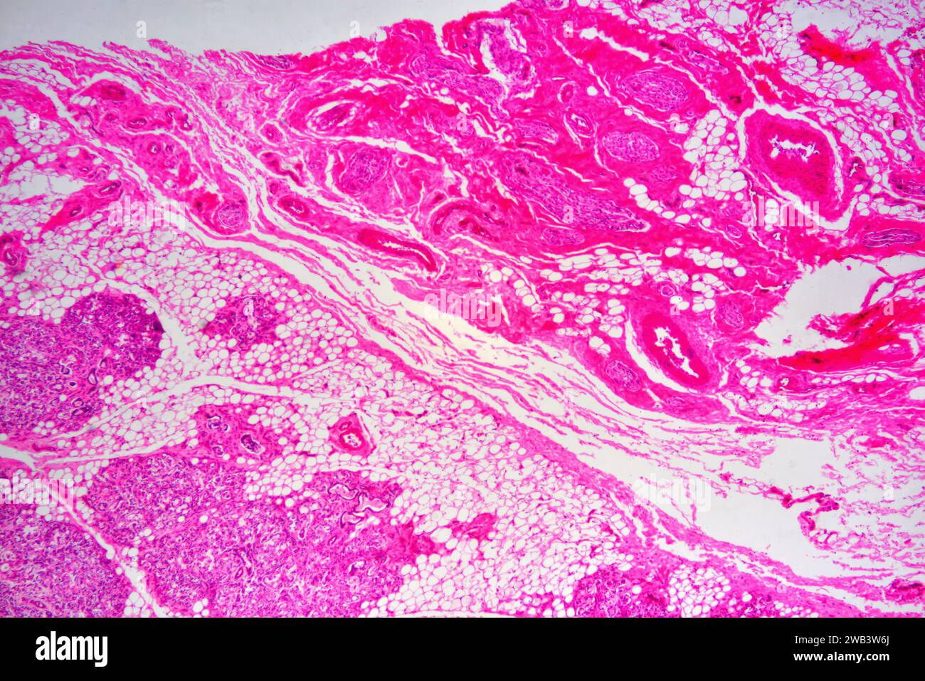 Human umbilical cord mucose hi-res stock photography and images - Alamy