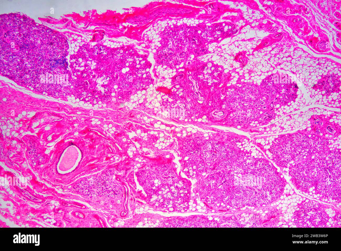 Human umbilical cord mucosa showing: mucous glands, loose conective ...