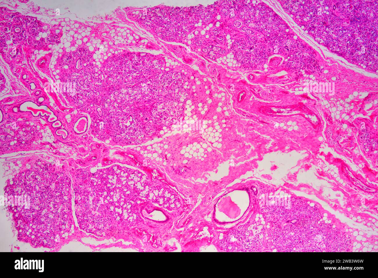Human umbilical cord mucosa showing: mucous glands, loose conective ...
